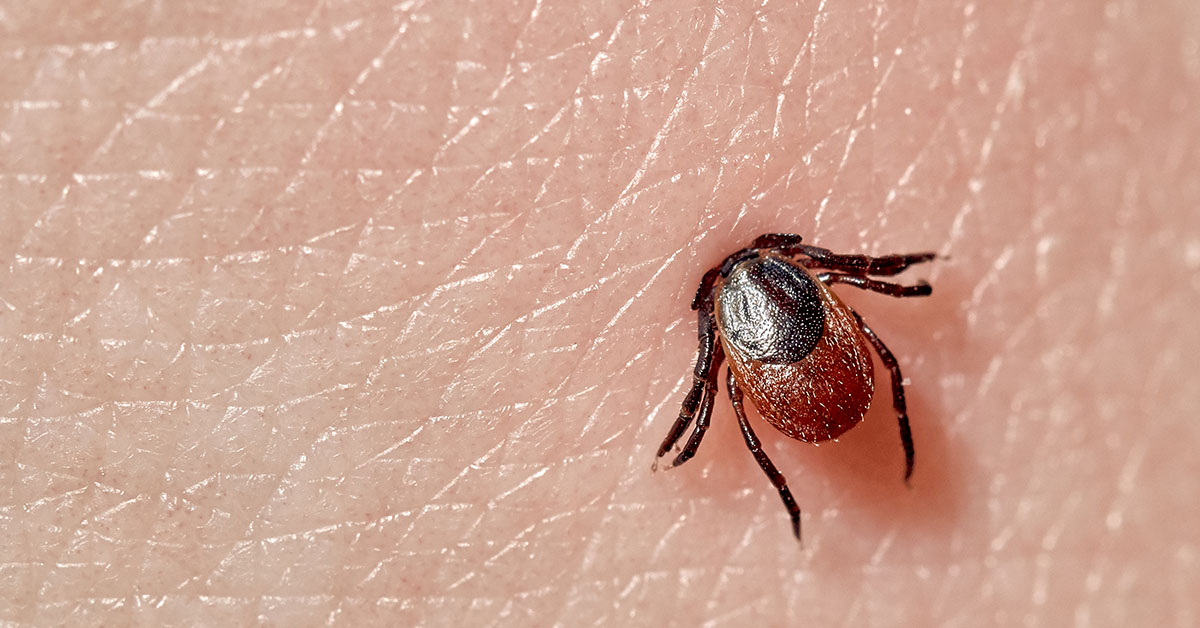 Zeckenbiss | Zecke erkennen, entfernen | Dr Leenarts